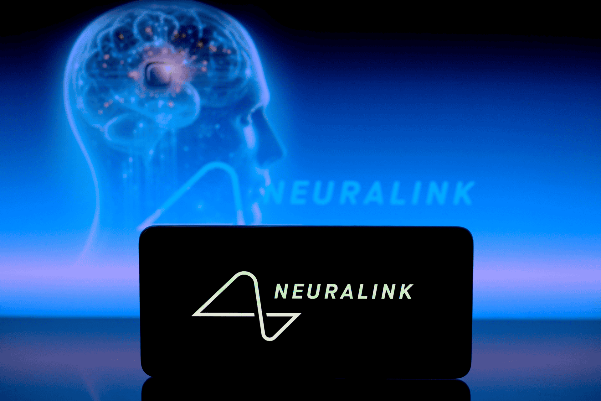 Neuralink: primeiro paciente com chip cerebral aparece em vídeo jogando ...